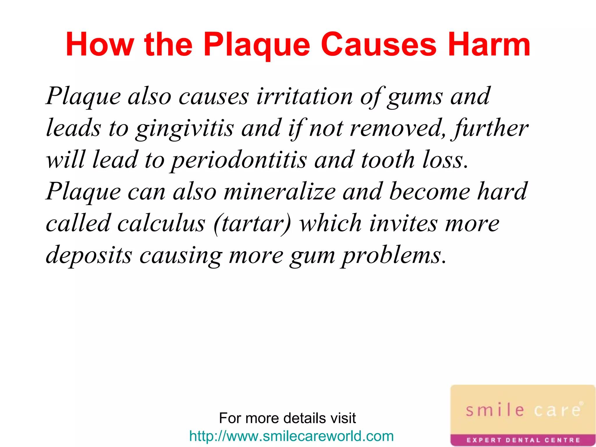 Dental plaque | PPT