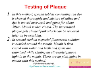 Dental plaque | PPT
