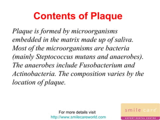 Dental plaque | PPT