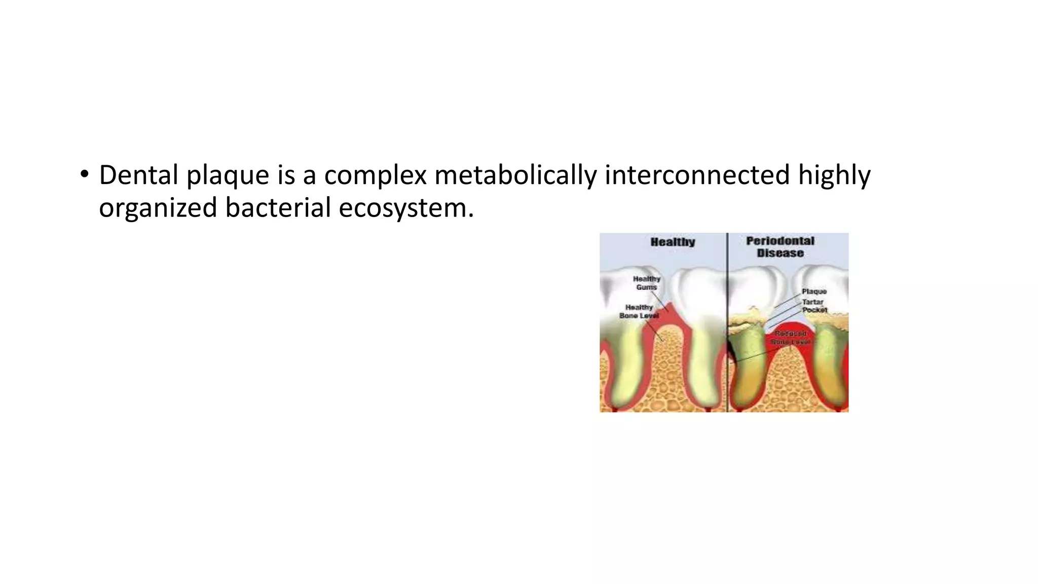 Dental plaque | PPTX