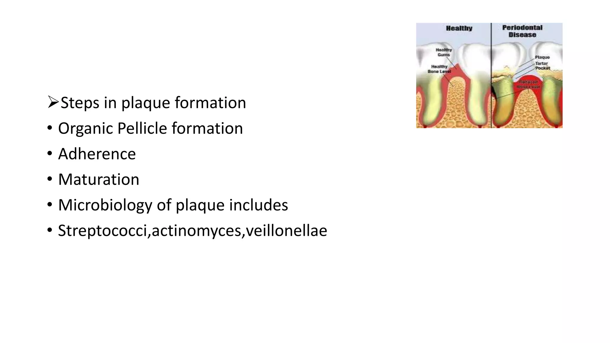 Dental plaque | PPTX