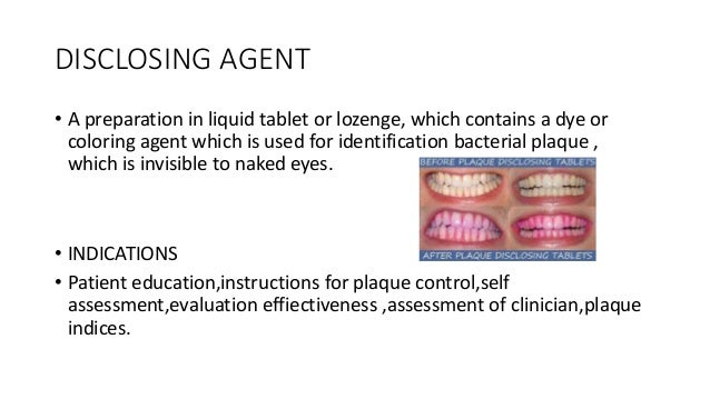 Dental plaque