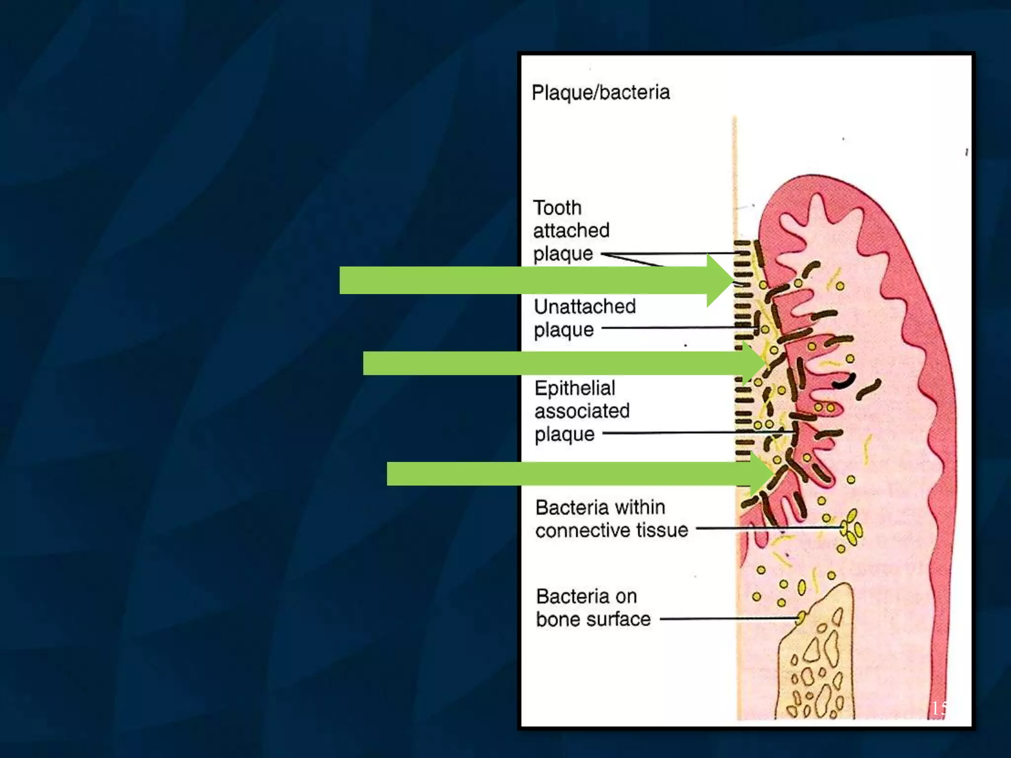 Dental Plaque | PPTX