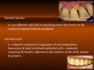Dental Plaque | PPTX