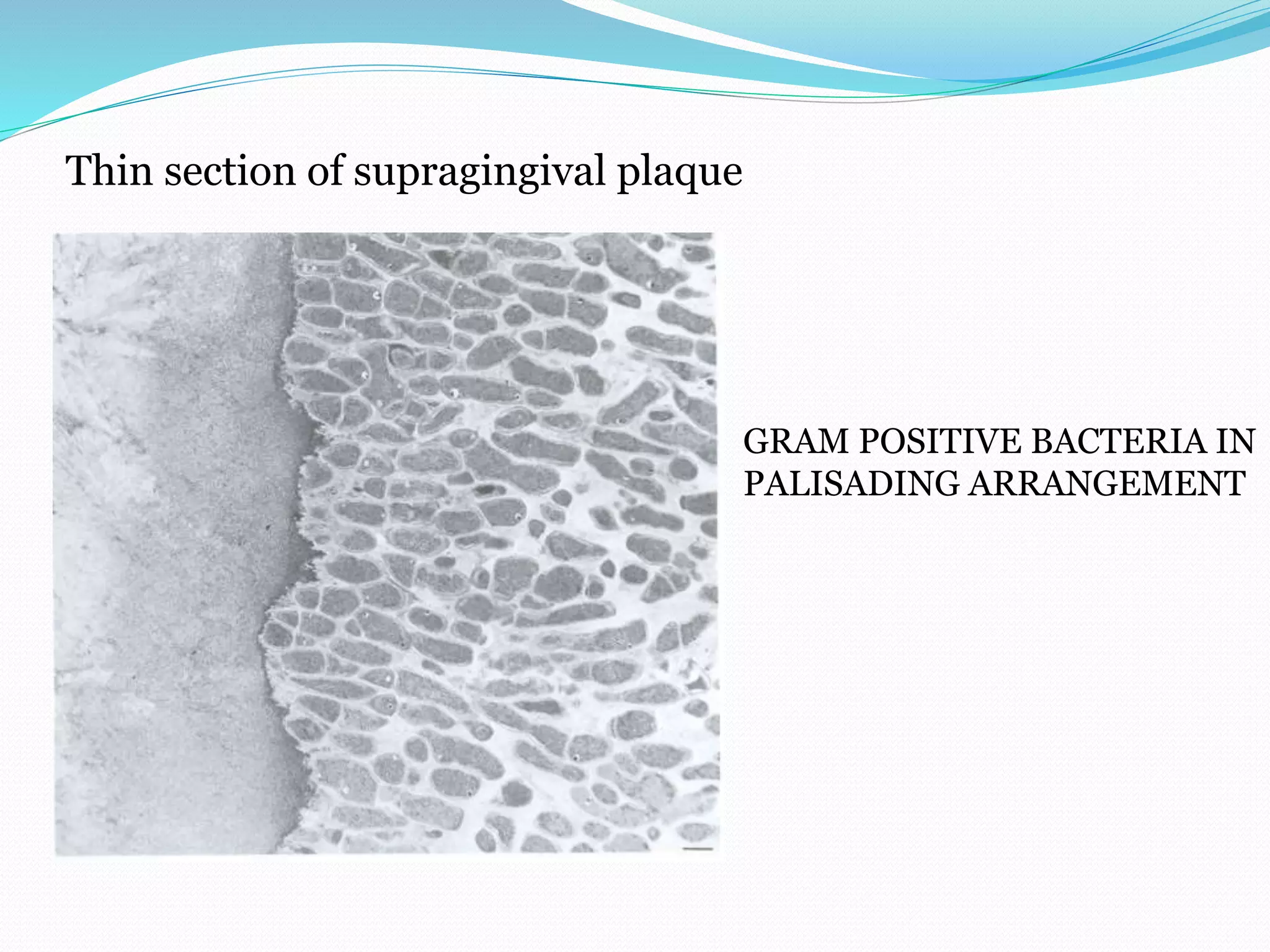 Dental plaque | PPTX