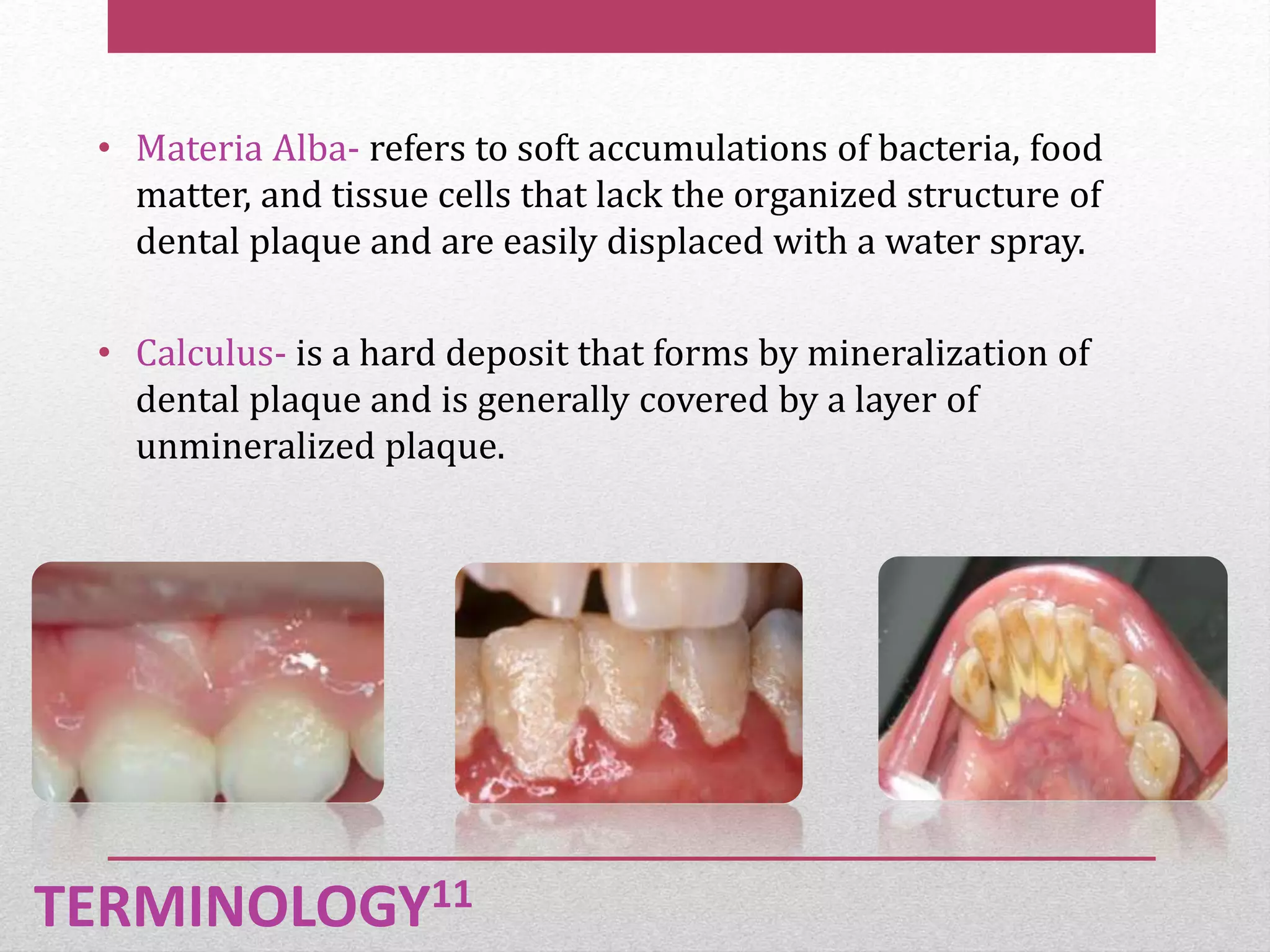 Dental plaque | PPTX