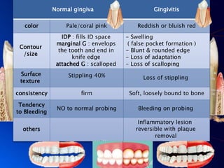 Dental plaque | PPTX