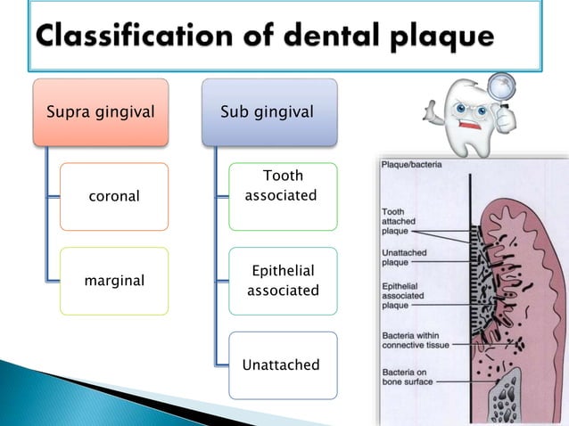 Dental plaque | PPTX