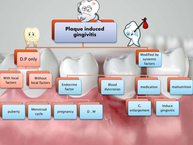Dental plaque | PPTX