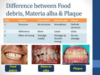Dental plaque | PPTX