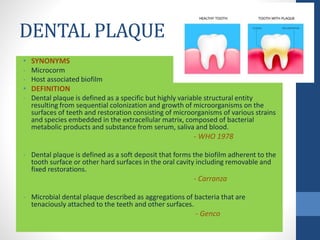 Dental plaque | PPTX