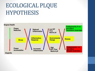 Dental plaque | PPTX