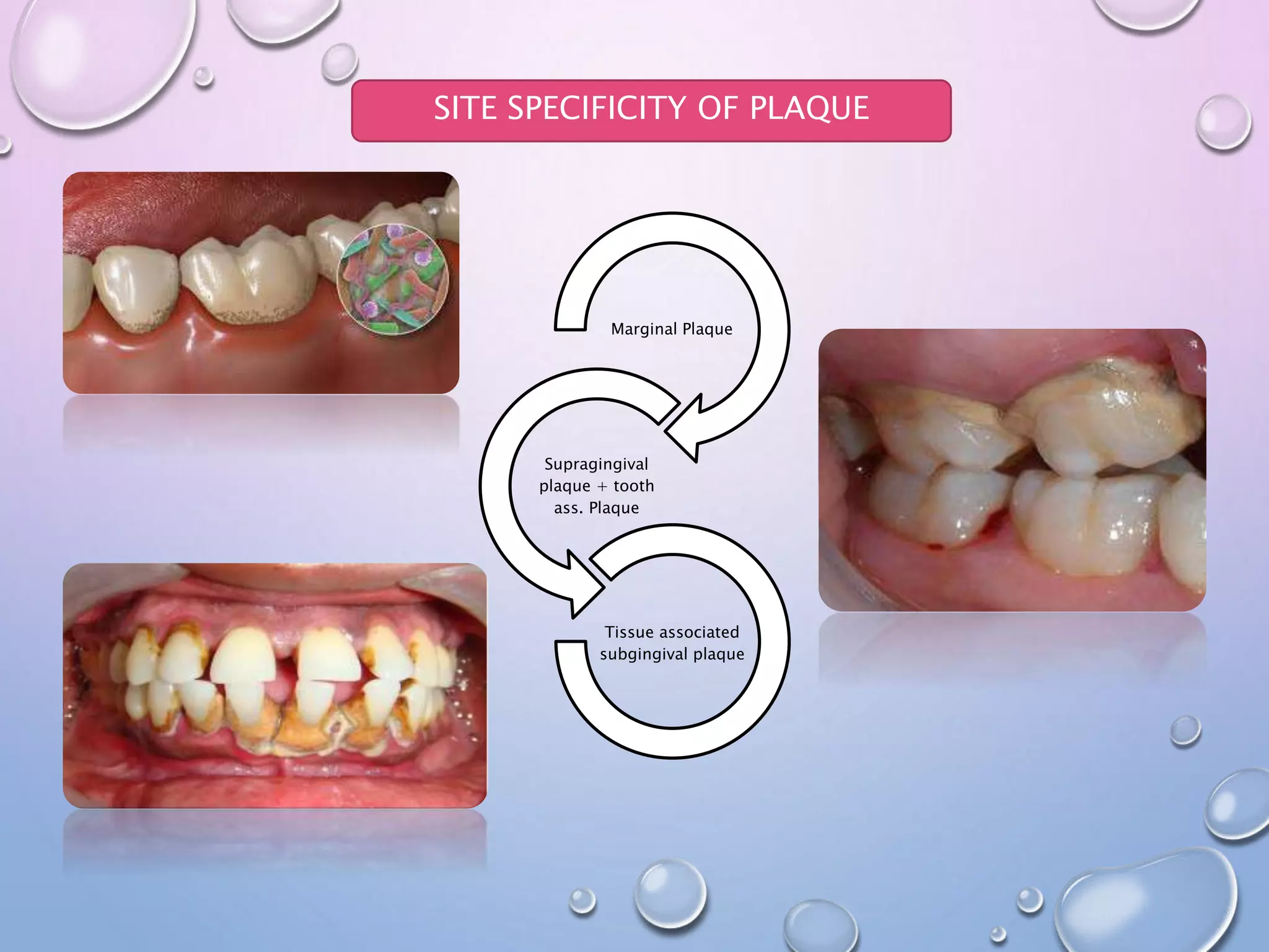Dental plaque.pptx