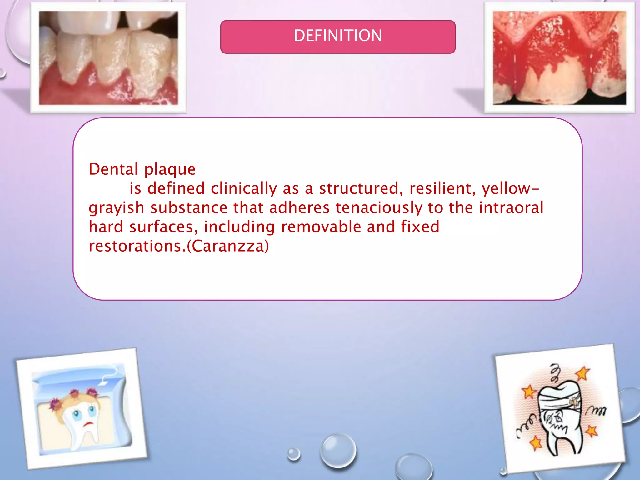 Dental plaque.pptx