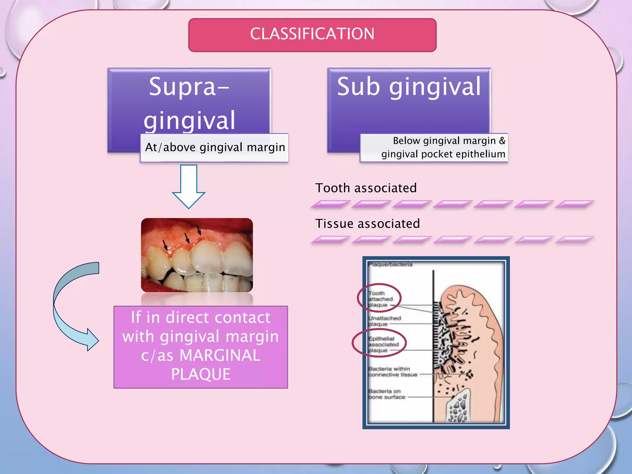 Dental plaque.pptx