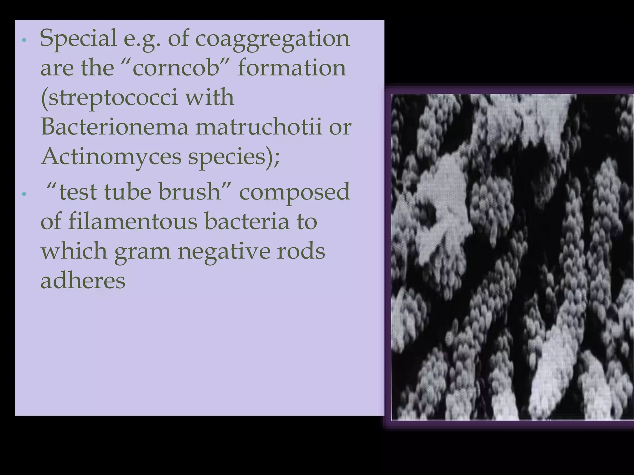 Dental plaque.ppt