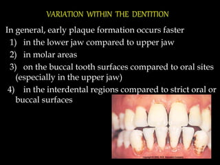 Dental plaque.ppt