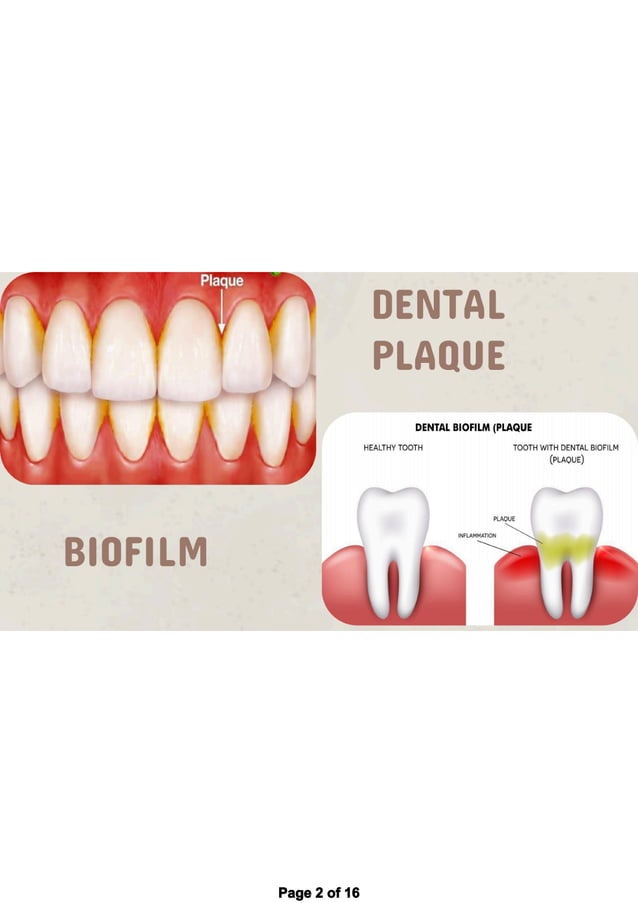 Dental plaque and Biofilms- def,formation,.. .pdf