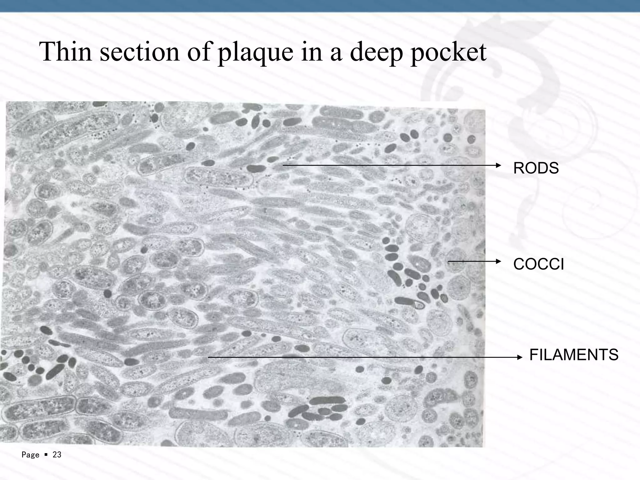 DENTAL PLAQUE - PART 1 | PPTX