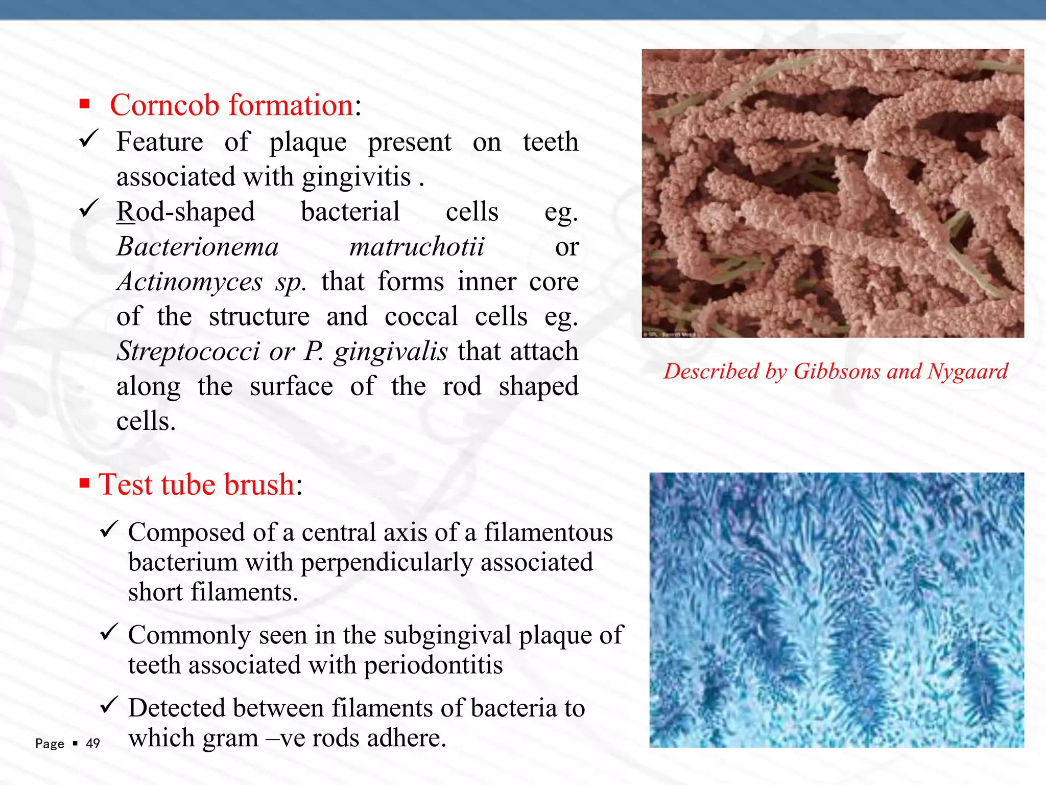 DENTAL PLAQUE - PART 1 | PPTX