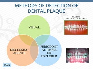 DENTAL PLAQUE - PART 2 (BIOFILM) | PPTX