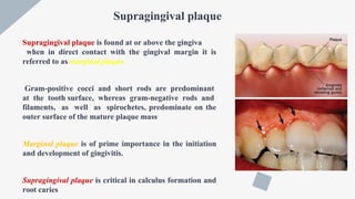 Dental Plaque Biofilm byDr. Mohammed.pptx