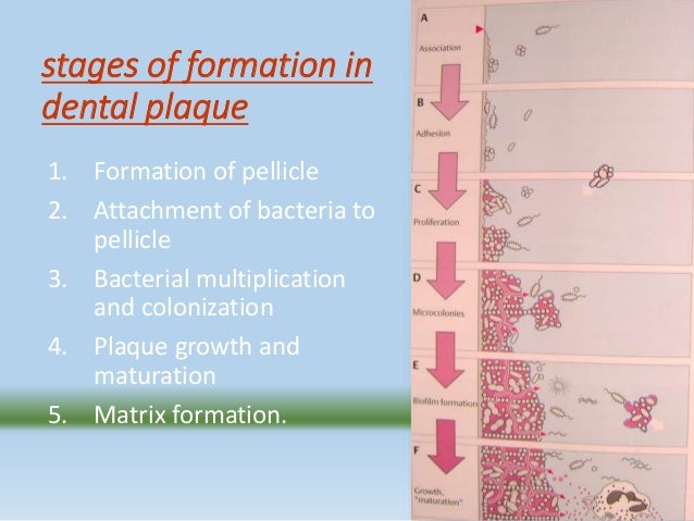 Dental plaque