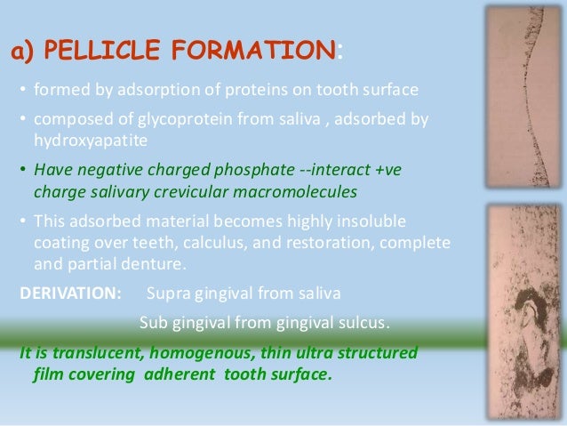 Dental plaque