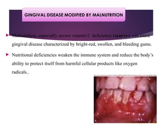 Comprehensive Overview of Dental Plaque: Formation, Classification, and ...