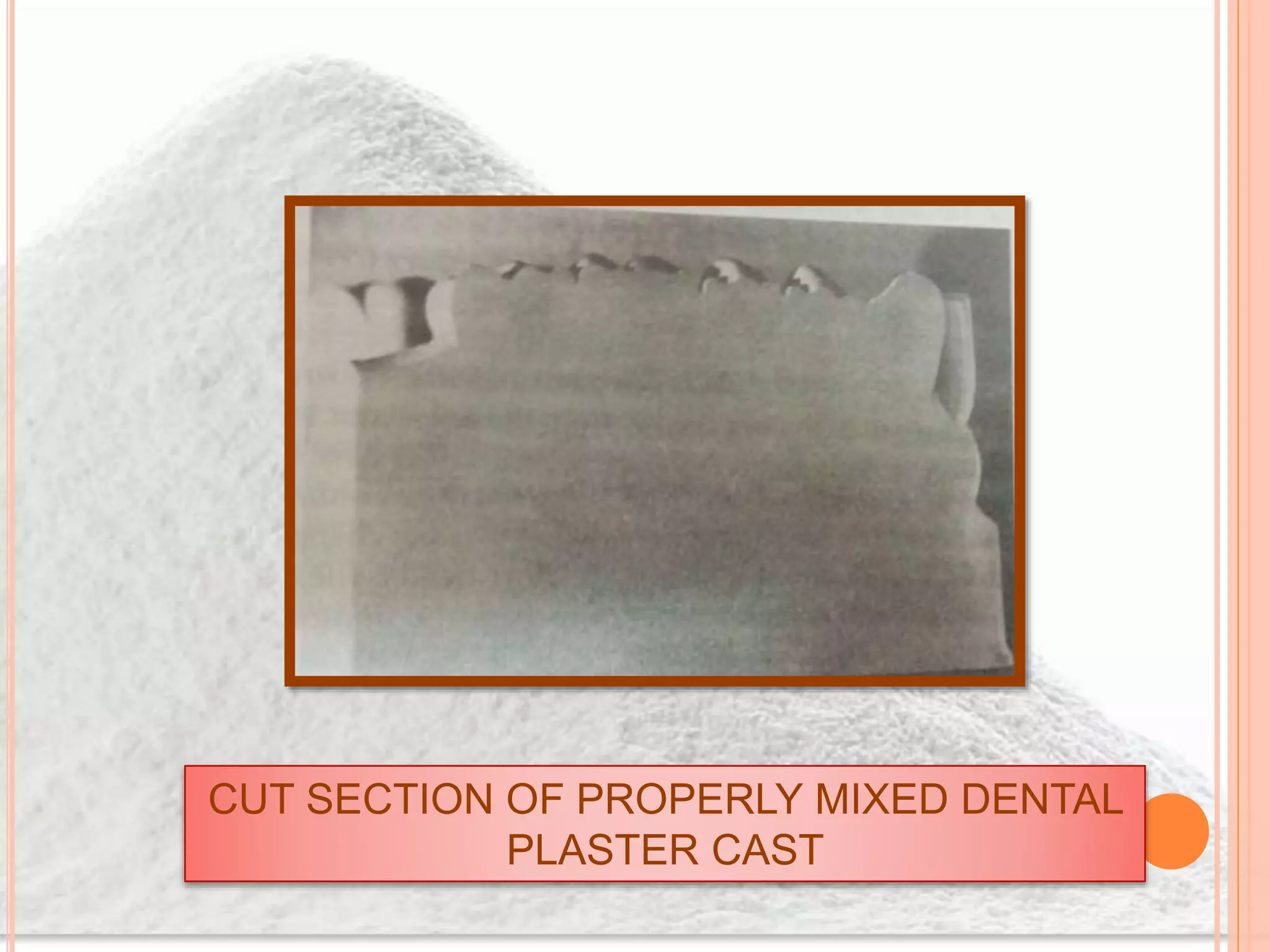 DENTAL PLASTER | PPTX