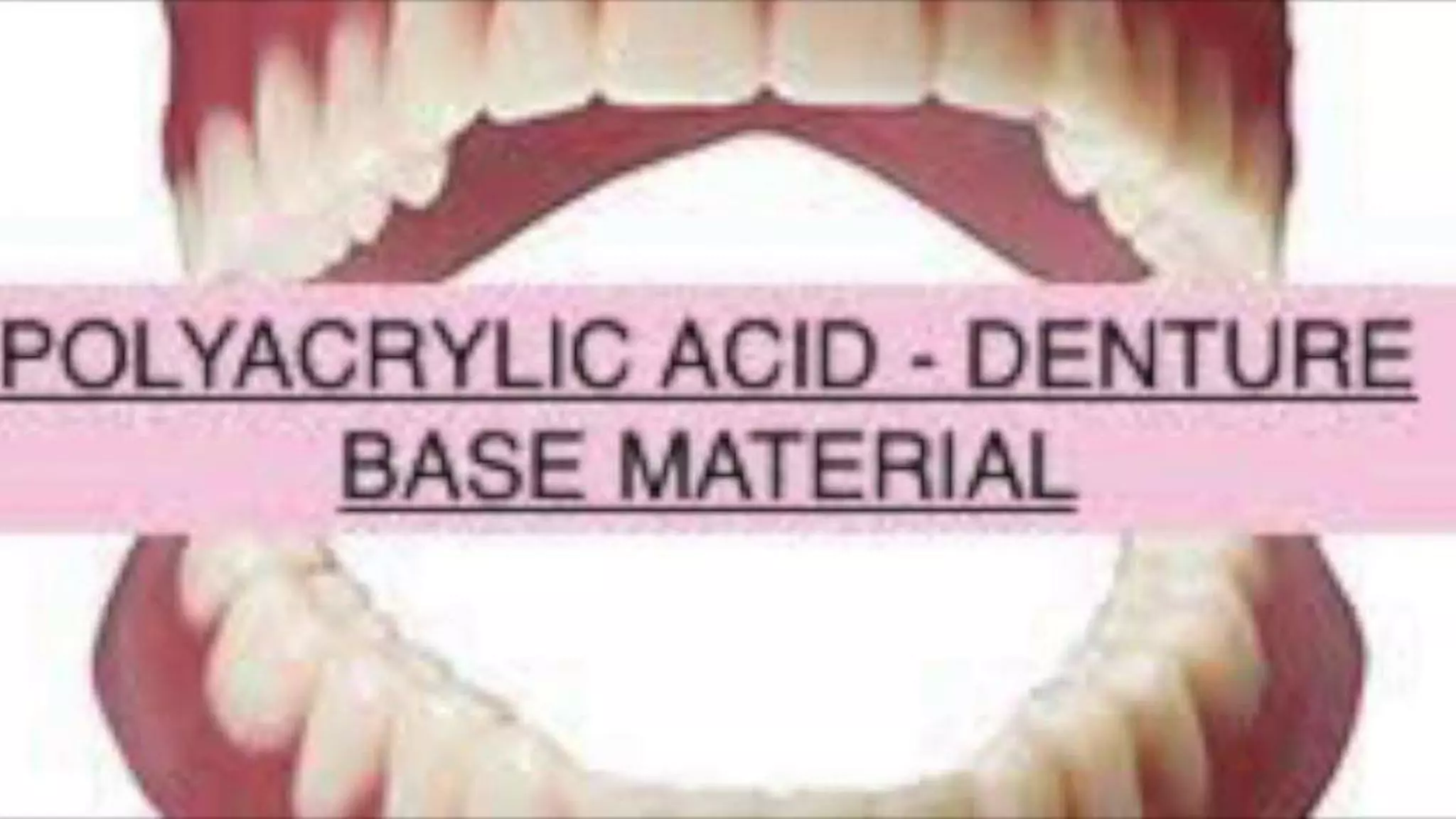 Dental polymers with recent advancements in dental base techniques 2 ...