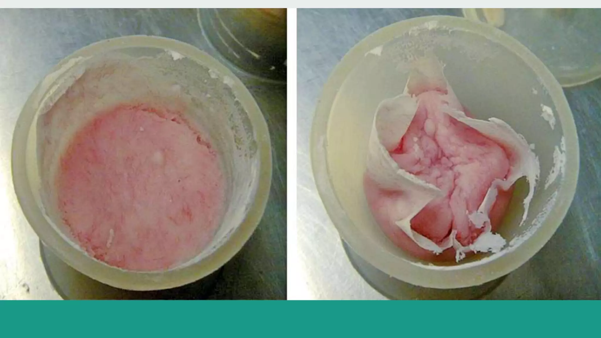 Dental polymers with recent advancements in dental base techniques 2 | PPTX