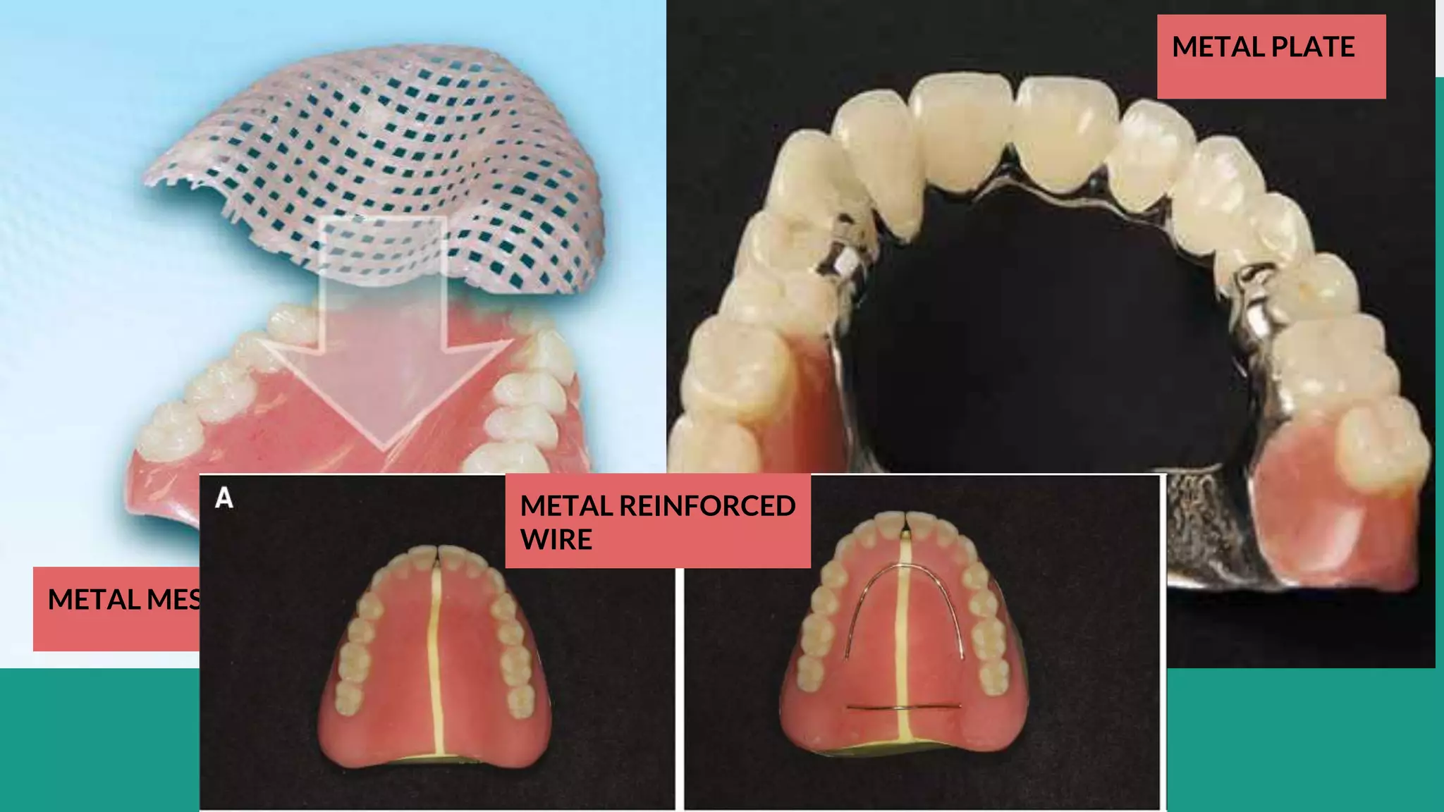 Dental polymers with recent advancements in dental base techniques 2 | PPTX