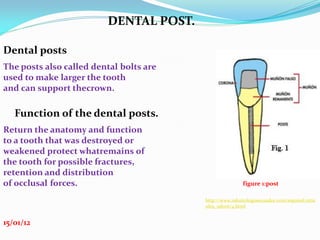 Dental post | PDF