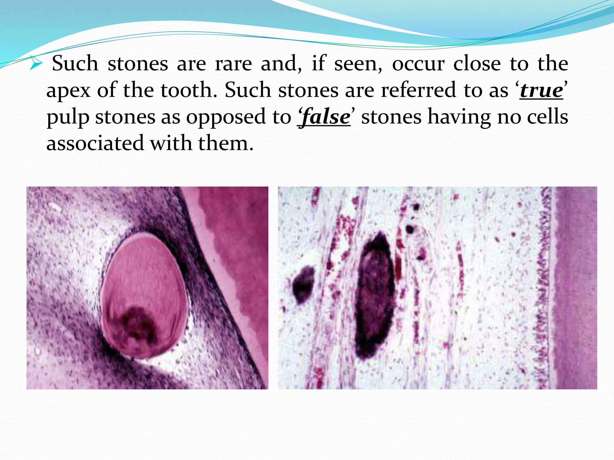 Dental pulp | PPTX