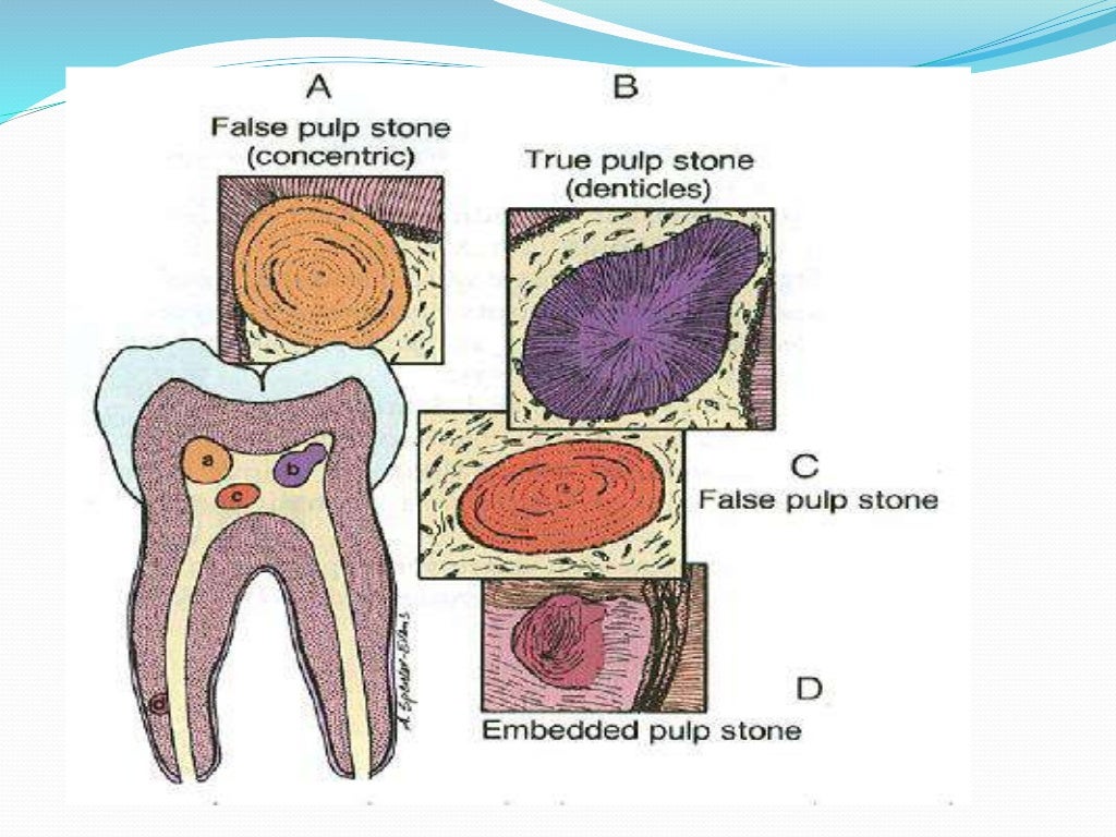 Dental pulp