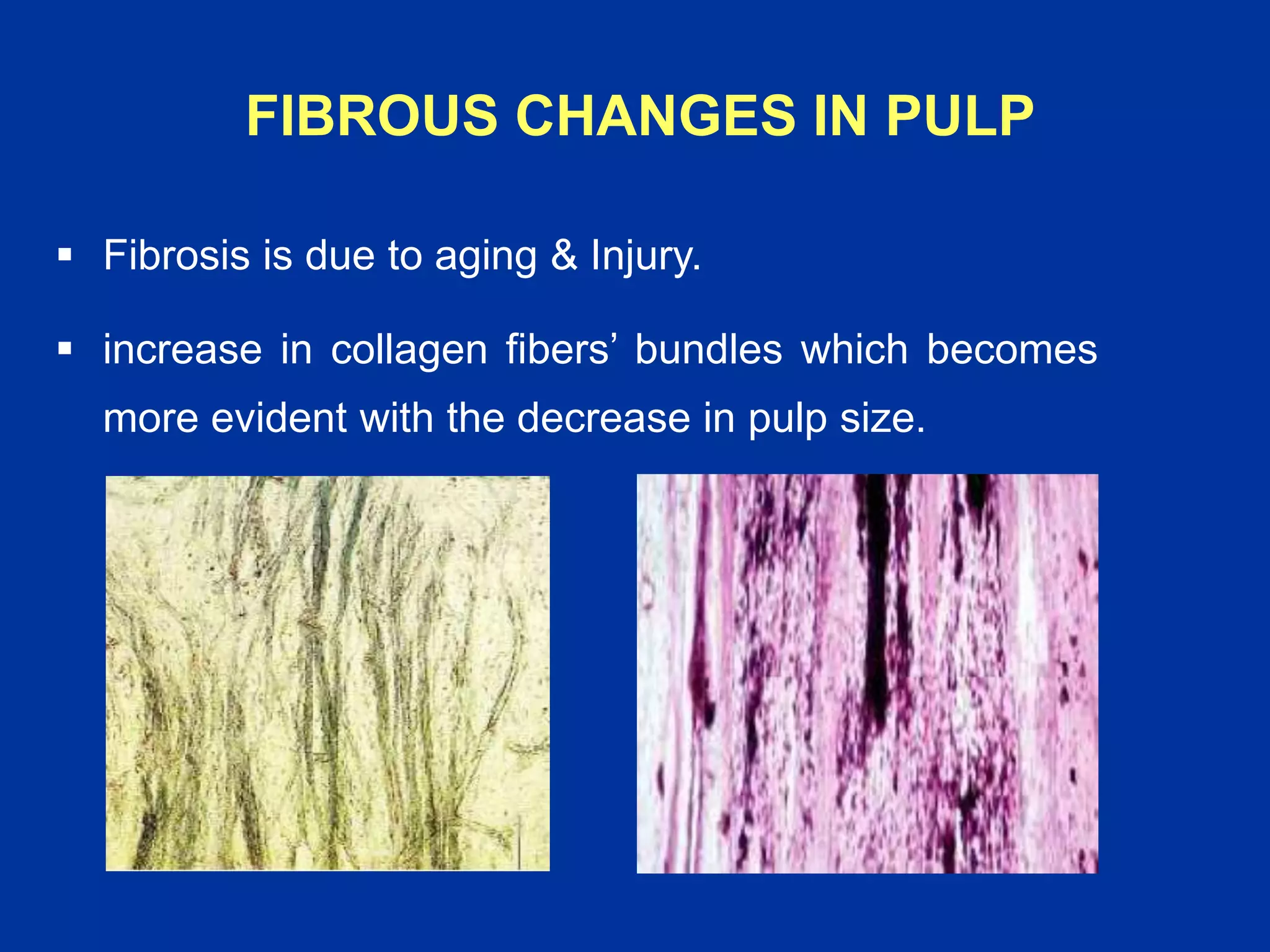 Dental Pulp.ppt