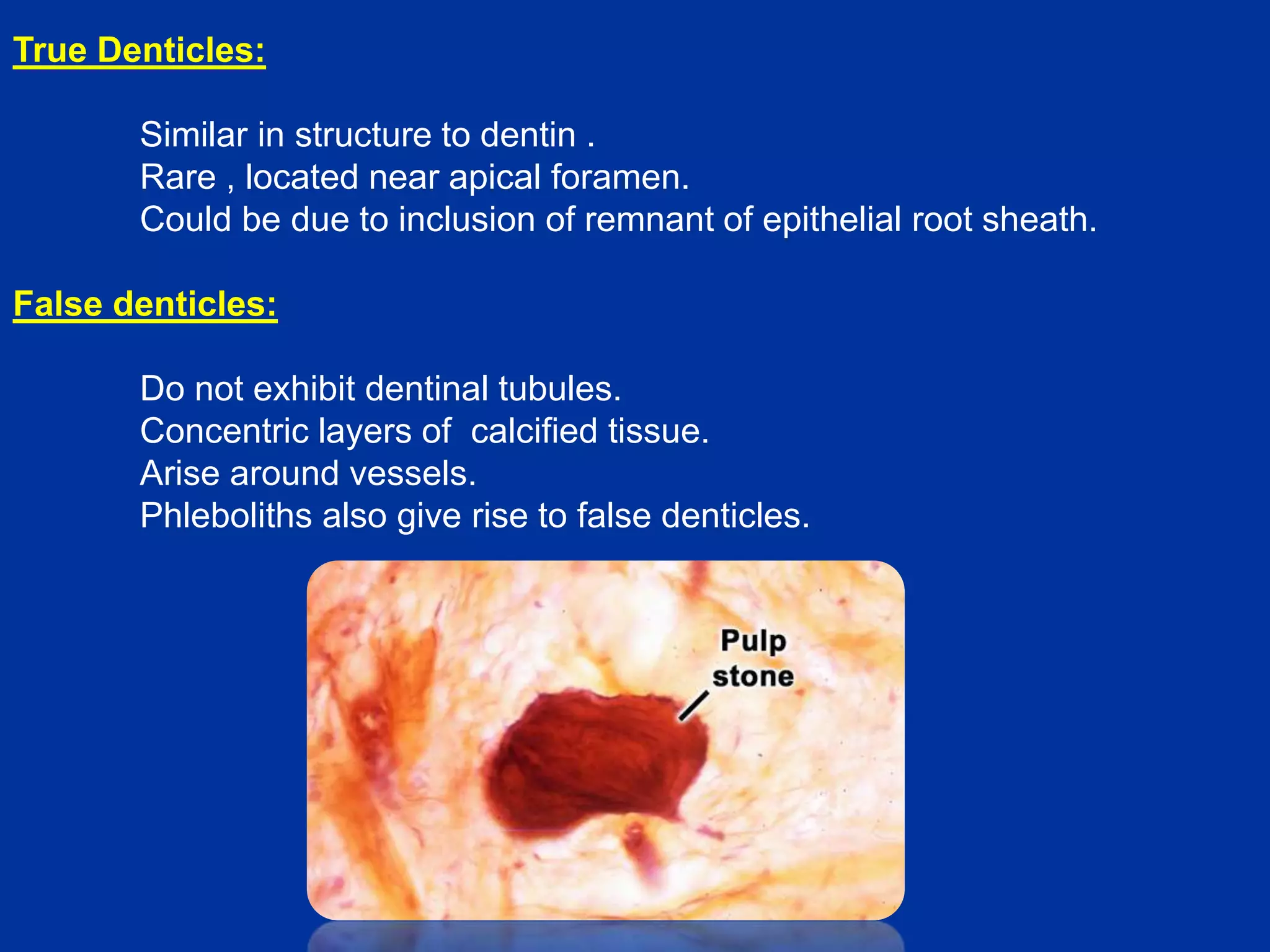 Dental Pulp.ppt | Dental Health | Diseases and Conditions
