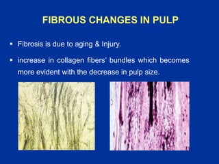 Dental Pulp.ppt