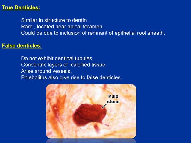 Dental Pulp.ppt | Dental Health | Diseases and Conditions