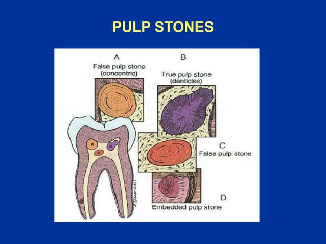 Dental Pulp.ppt | Dental Health | Diseases and Conditions
