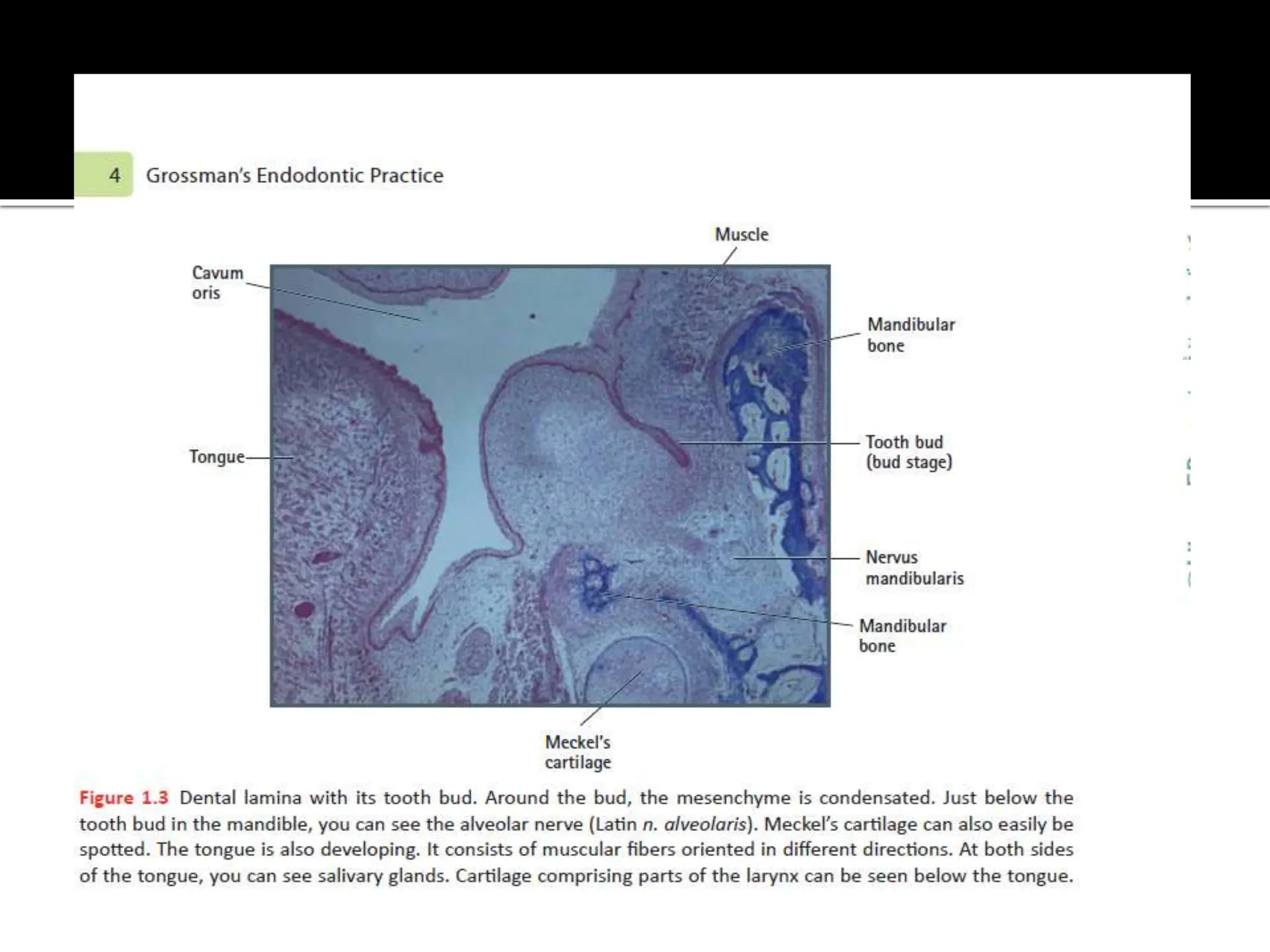 DENTAL_PULP_AND_PERIRADICULAR_TISSUE (8).pptx, INFLAMMATION, N DISEASES ...