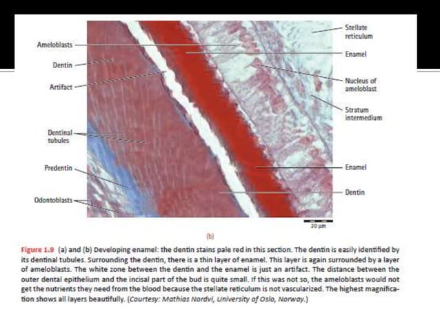 DENTAL_PULP_AND_PERIRADICULAR_TISSUE (8).pptx, INFLAMMATION, N DISEASES ...