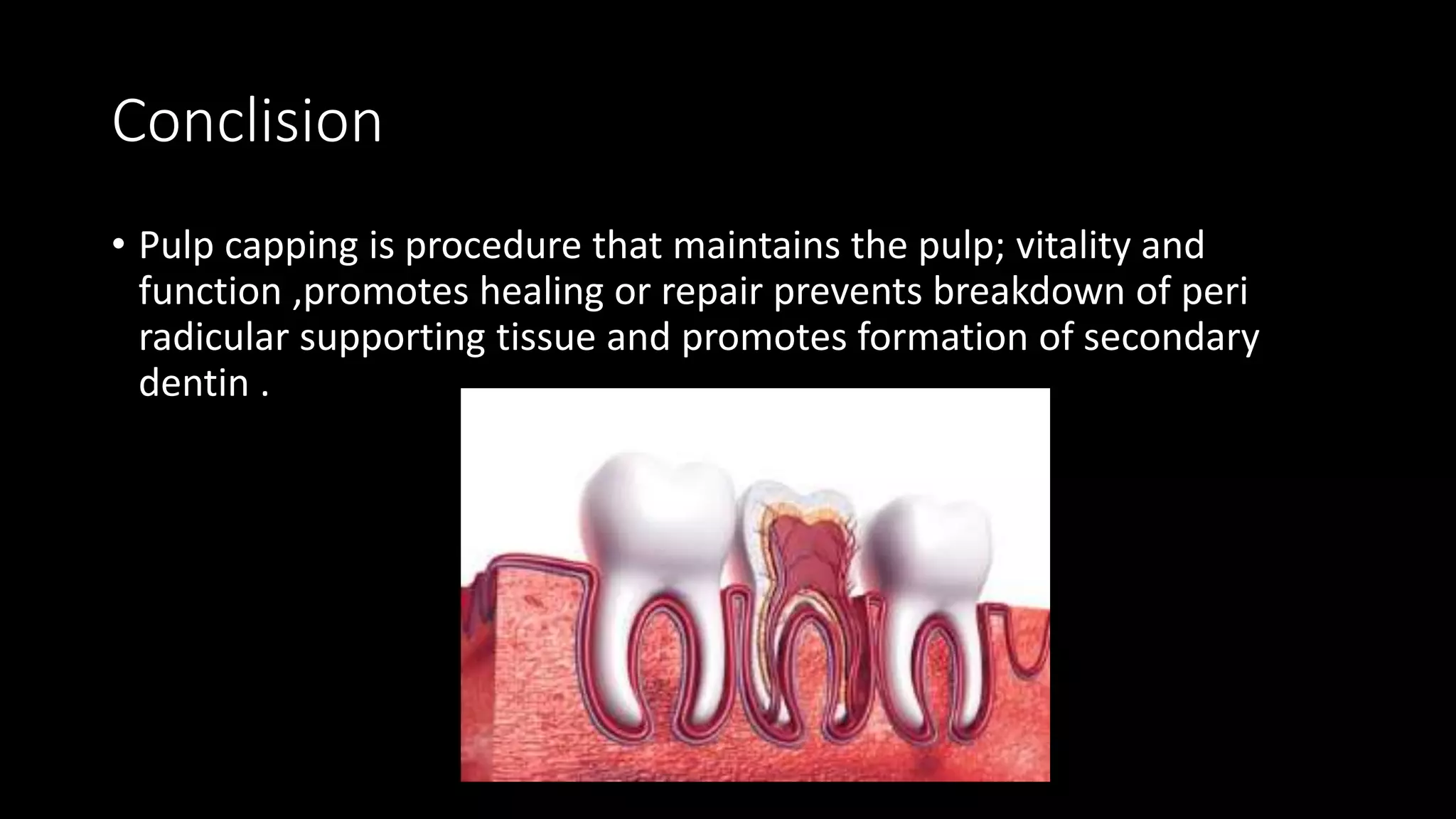 DENTAL PULP AND PULP CAPPING.pptx