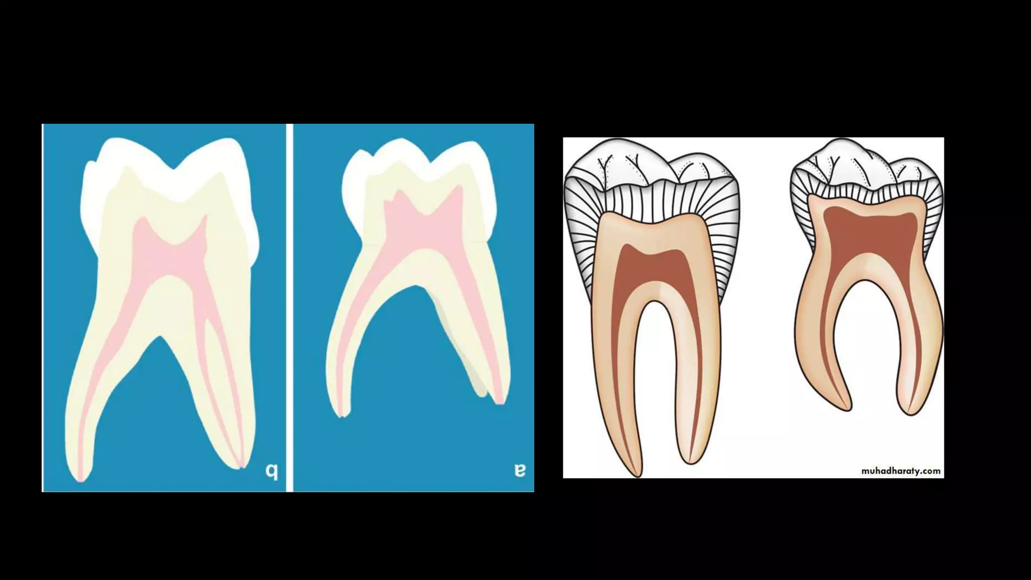 DENTAL PULP AND PULP CAPPING.pptx