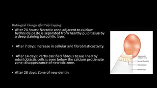 DENTAL PULP AND PULP CAPPING.pptx