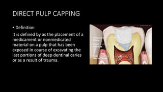 DENTAL PULP AND PULP CAPPING.pptx