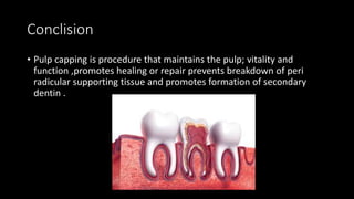 DENTAL PULP AND PULP CAPPING.pptx