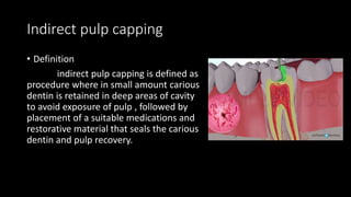 DENTAL PULP AND PULP CAPPING.pptx