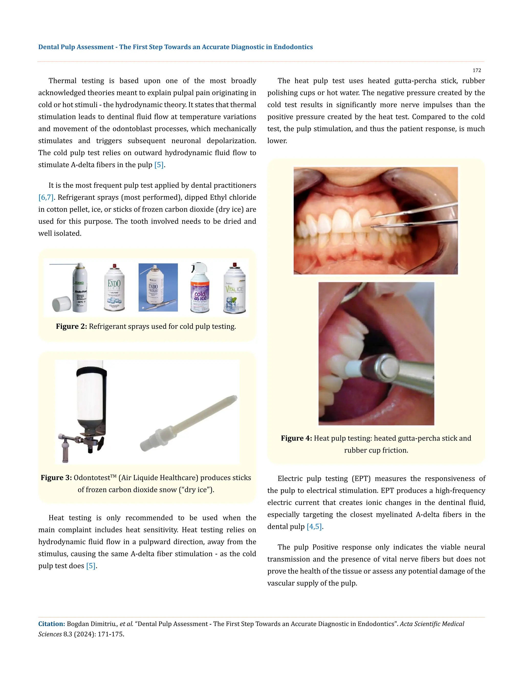 Dental Pulp Assessment - The First Step Towards an Accurate Diagnostic ...